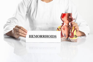 4 Types Of Hemorrhoids & How They Are Treated